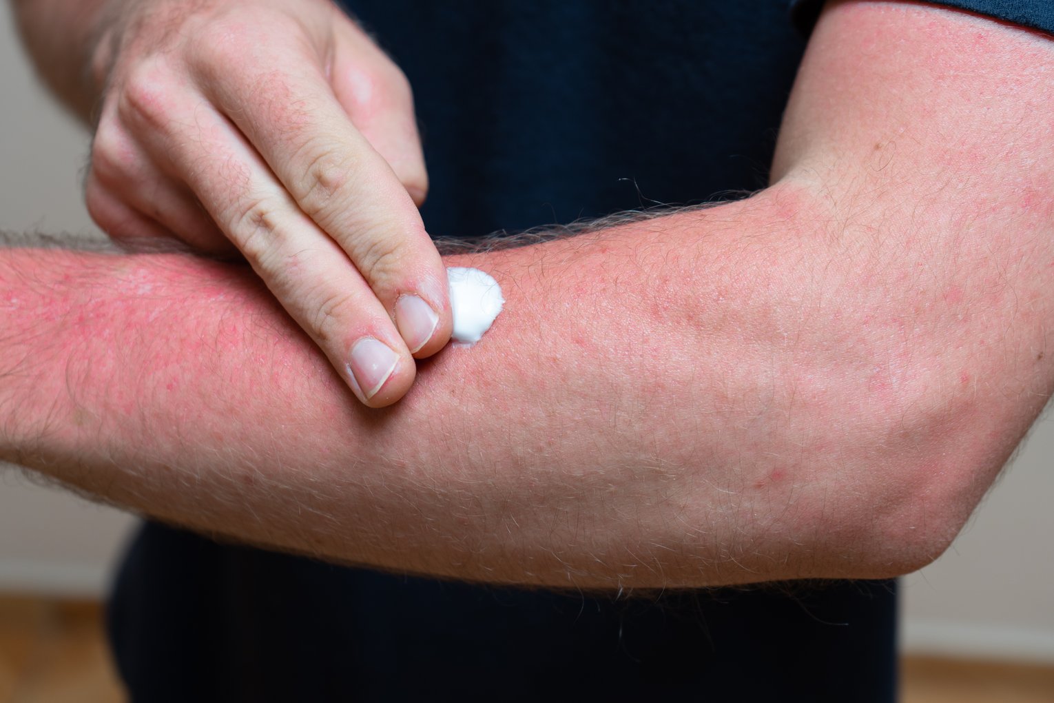 Staying Safe and Protecting Your Health in Extreme Heat